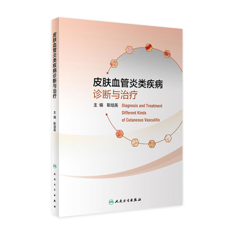 皮肤血管炎类疾病诊断与治疗