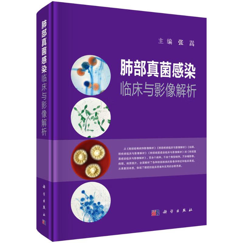 全新 肺部真菌感染临床与影像解析(精) 张嵩 科学出版社