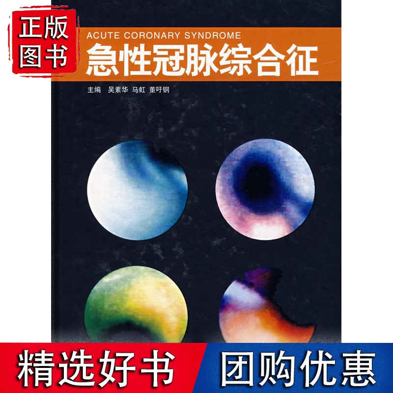 急性冠脉综合征