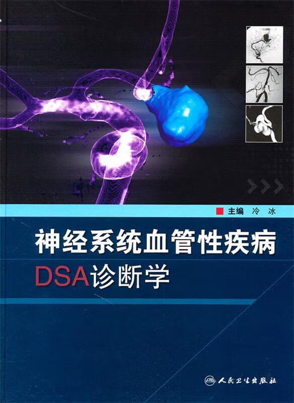 神经系统血管性疾病DSA诊断学