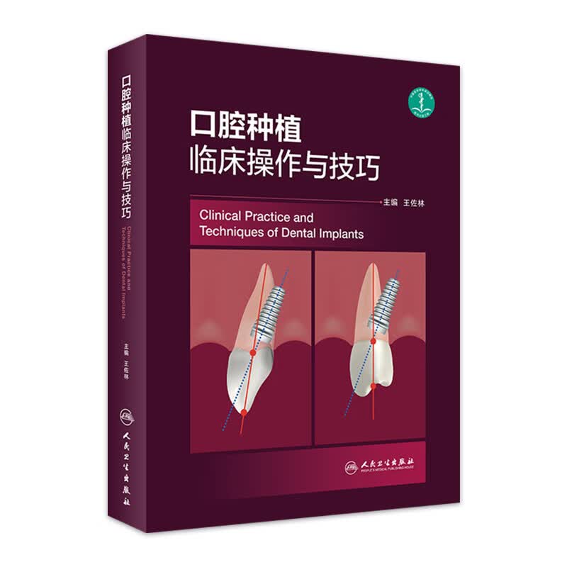 口腔种植临床操作与技巧