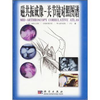 磁共振成像：关节镜对照图谱