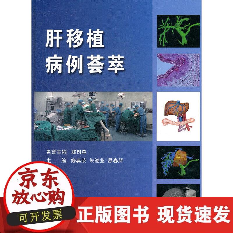 【现货】肝移植病例荟萃