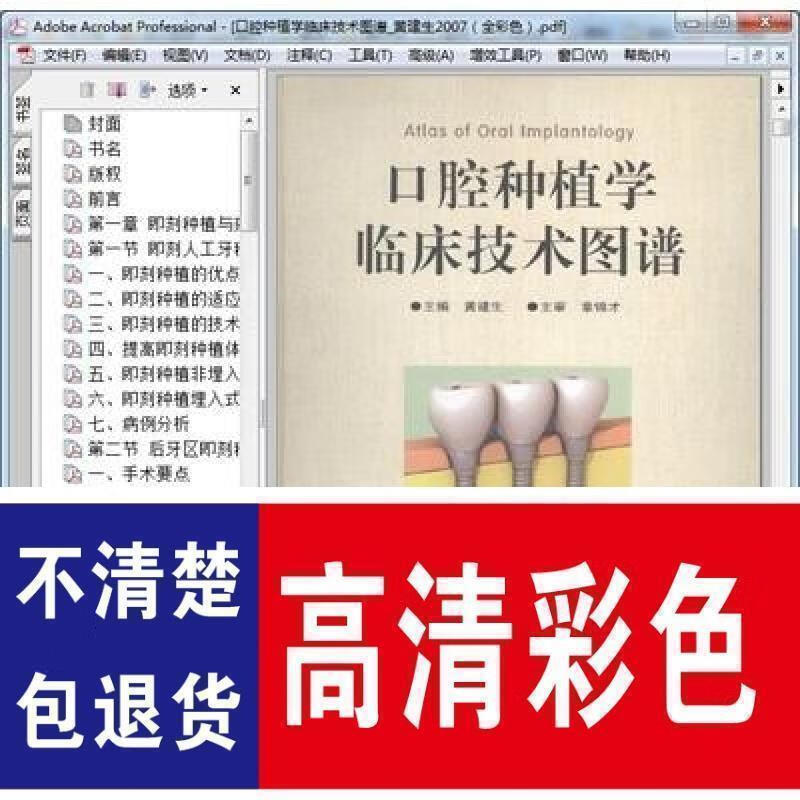 口腔种植学临床图谱_黄建生2007(全彩色)