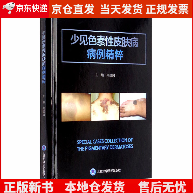 少见色素性皮肤病病例精粹《现货速发》，