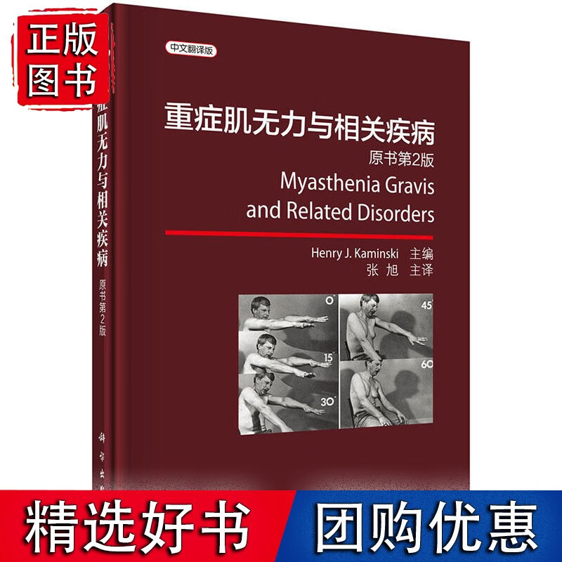 重症肌无力与相关疾病