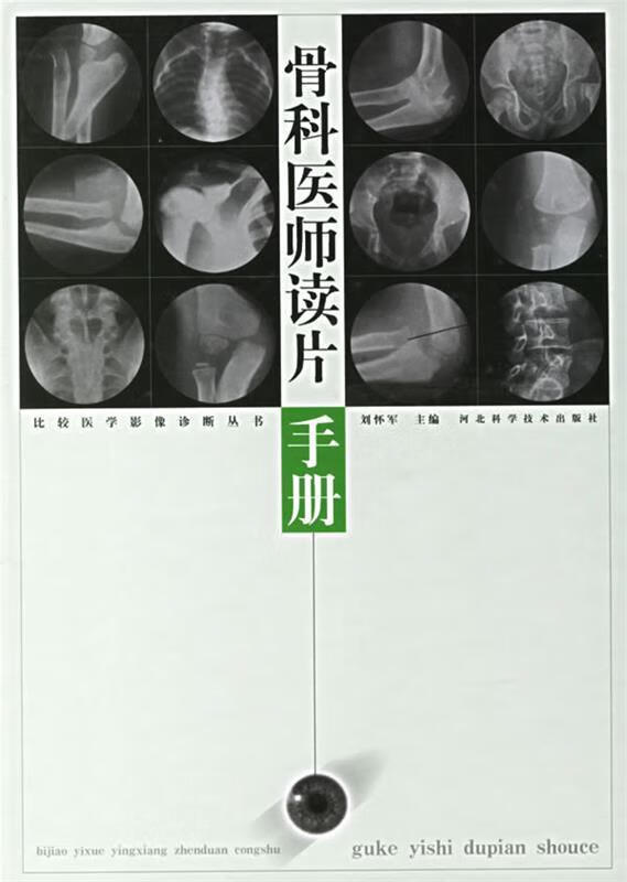 骨科医师读片手册 刘怀军 主编