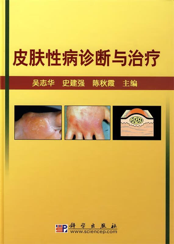 皮肤性病诊断与治疗