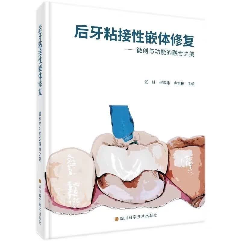 后牙粘接性嵌体修复 牙医修复嵌体粘接(铜版纸或白卡纸印刷)
