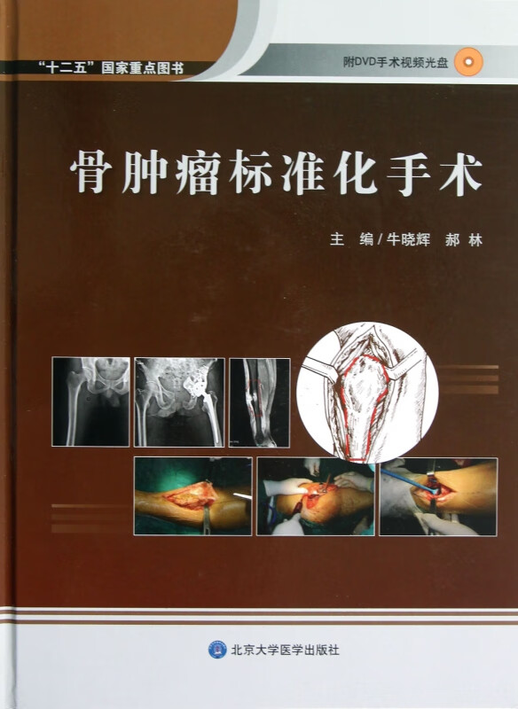 骨肿瘤标准化手术(附光盘)(精)