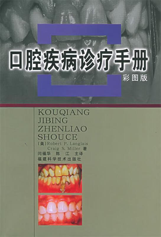 口腔疾病诊疗手册
