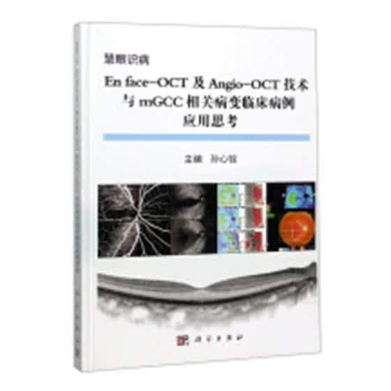 En face-OCT及Angio-OCT技术与mGCC相关病变临床病例应用思考 孙心铨 科学出