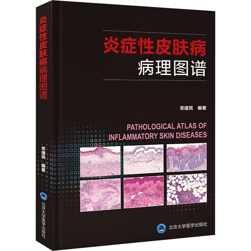炎症性皮肤病病理图谱
