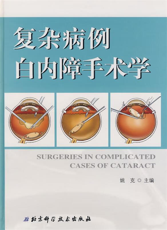 复杂病例白内障手术学