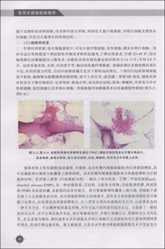 实用乳腺细胞病理学【精选】