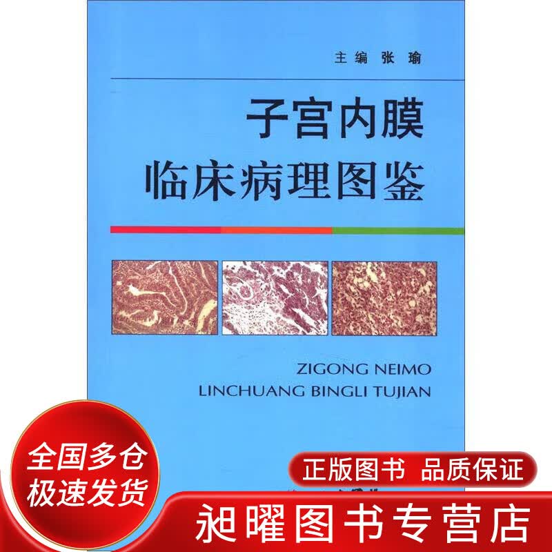子宫内膜临床病理图鉴【精选】