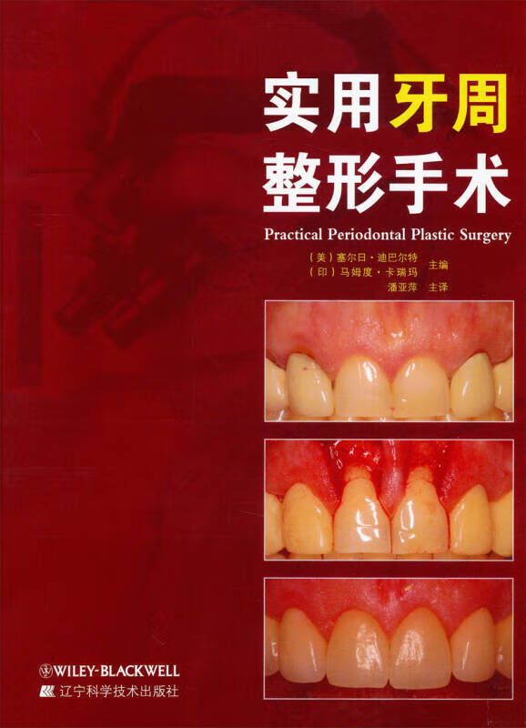实用牙周整形手术【好书】