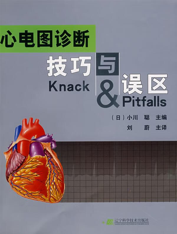 心电图诊断技巧与误区
