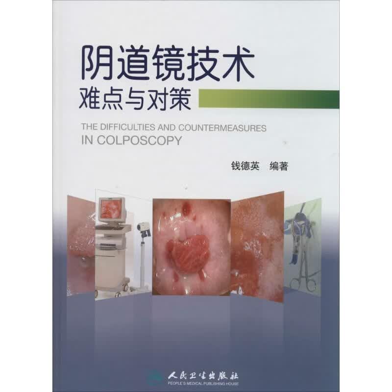 阴道镜技术难点与对策 钱德英