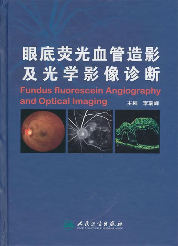眼底荧光血管造影及光学影像诊断 9787117133951 李瑞峰主编