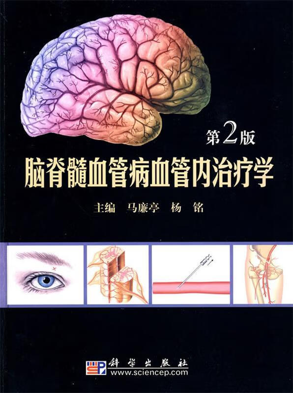 脑脊髓血管病血管内治疗学 第2版