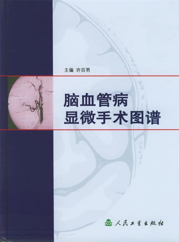 脑血管病显微手术图谱