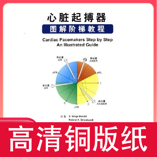 心脏起搏器图解阶梯 110克激光纸