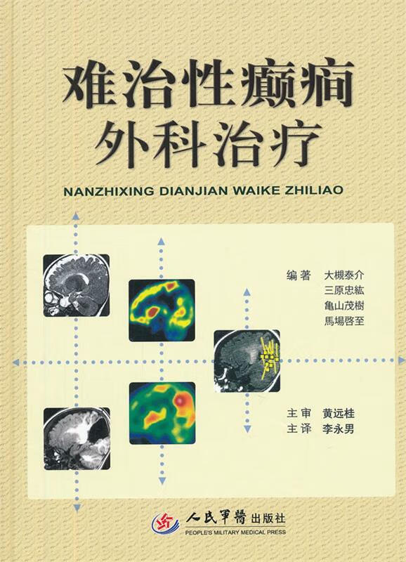 难治性癫痫外科治疗
