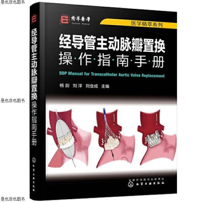 医学精萃系列--经导管主动脉瓣置换操作指南手册+经导管主动脉瓣