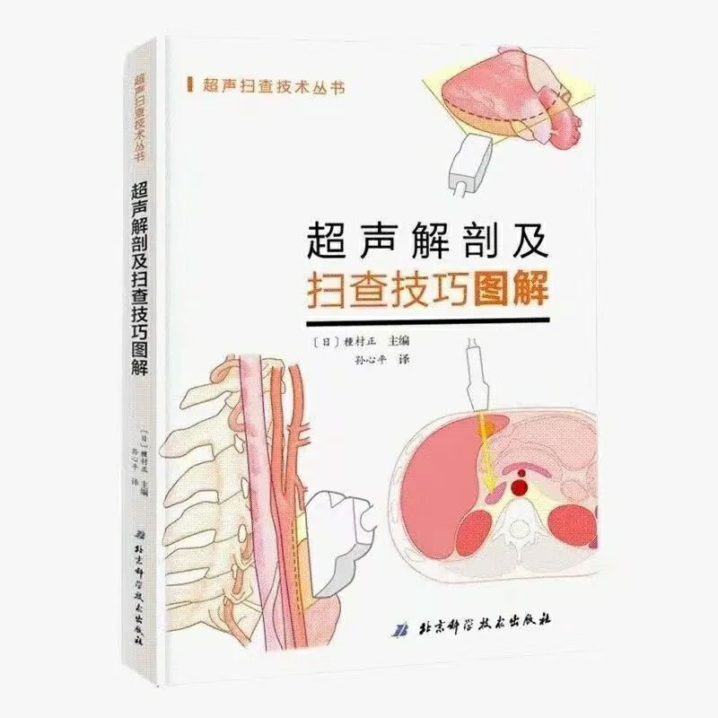 彩色印刷 2本 超声疾病诊断及扫查技巧图解+超声解剖及扫查技巧 超声解剖及扫查技巧图解