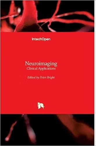 Neuroimaging - Clinical Applications
