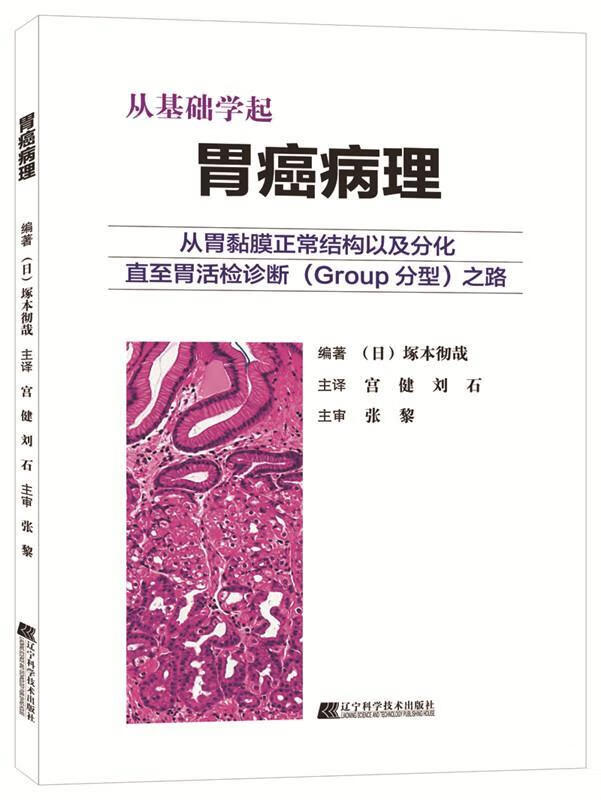 胃癌病理