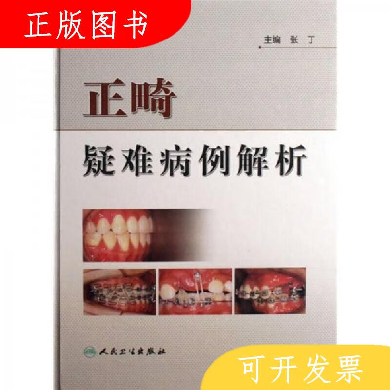 人民卫生出版社正畸疑难病例解析9787117087568张丁