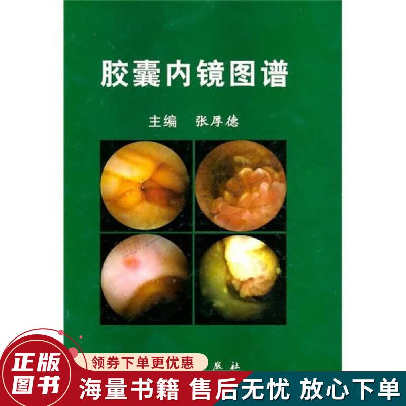 胶囊内镜图谱