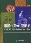 腹盆部CT和MRI病例解析