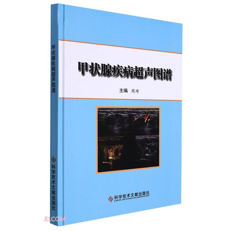 甲状腺疾病超声图谱9787518977789