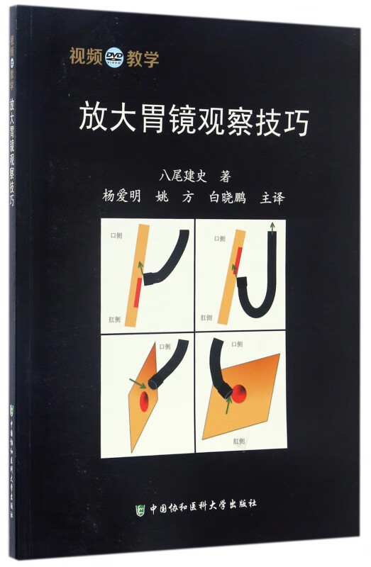 放大胃镜观察技巧(附光盘)