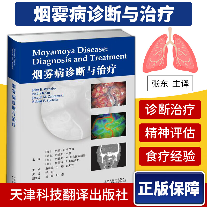烟雾病诊断与治疗