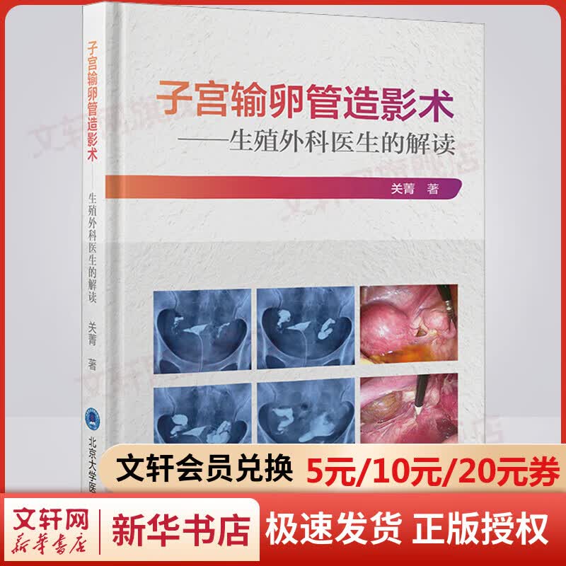 子宫输卵管造影术 生殖外科医生的解读 图书