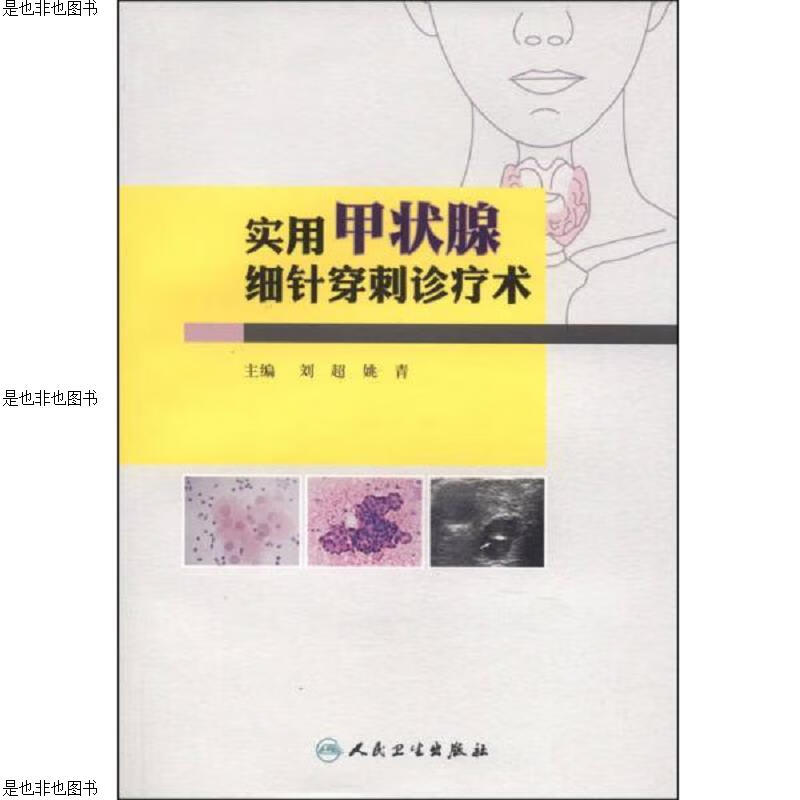 实用甲状腺细针穿刺诊疗术