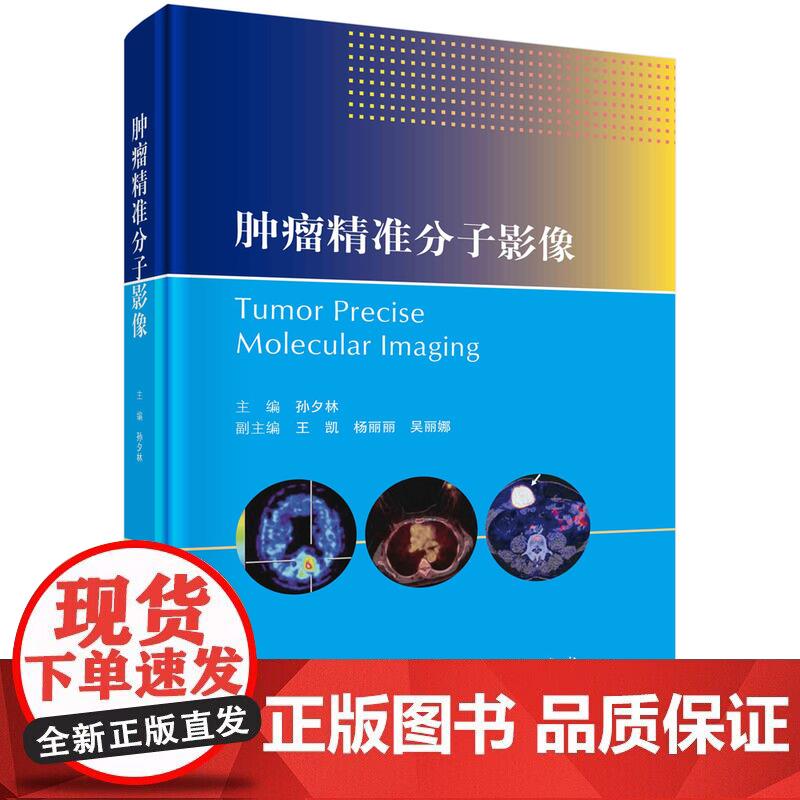 肿瘤精准分子影像