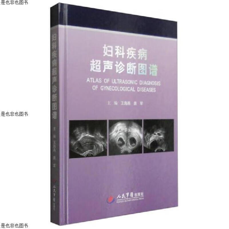 妇科疾病超声诊断图谱