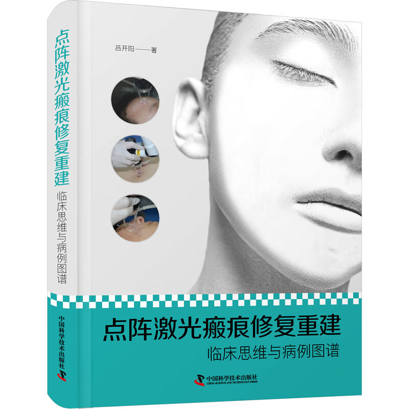 点阵激光瘢痕修复重建 临床思维与病例图谱 图书