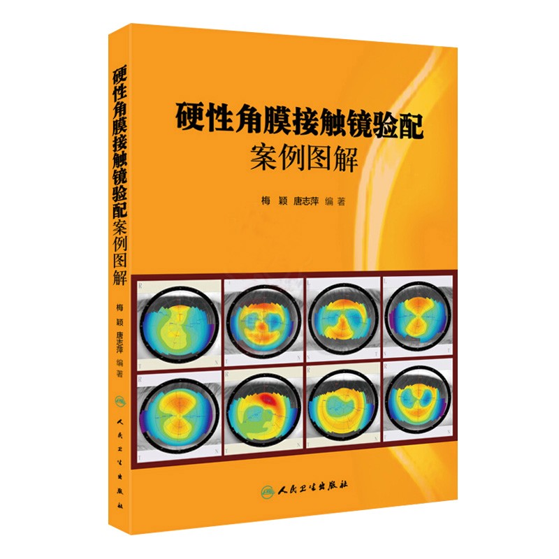 硬性角膜接触镜验配案例图解 梅颖 唐志萍主编 人民卫生出版社 眼科学参考工具书籍眼角膜治疗图谱 9787117208857