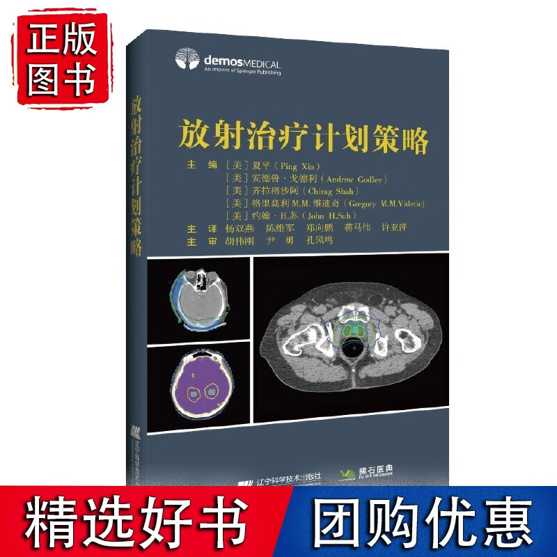 放射治疗计划策略