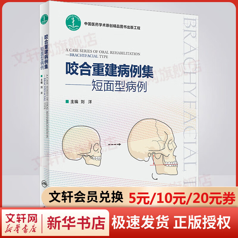 咬合重建病例集——短面型病例 图书
