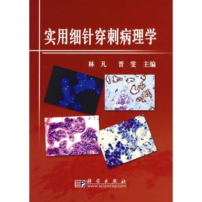 实用细针穿刺病理学 林凡,晋雯