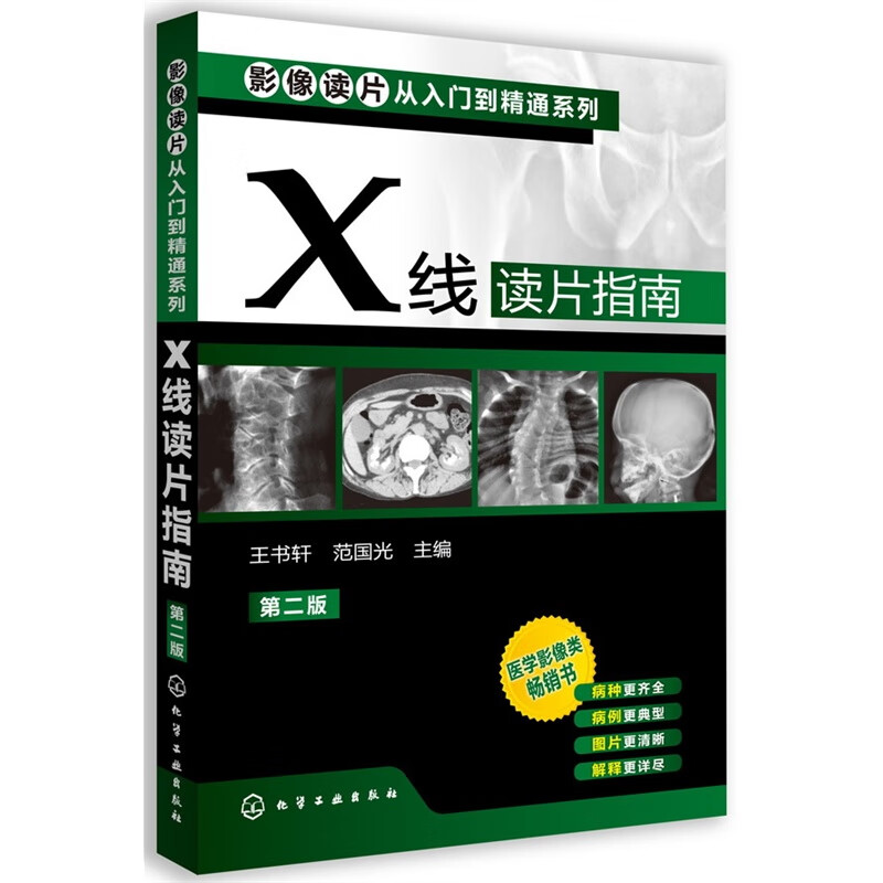 X线读片指南(第二版)
