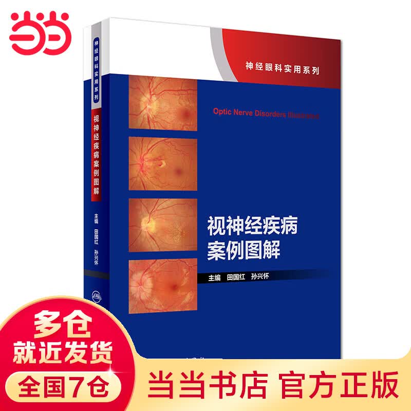 视神经疾病案例图解（神经眼科实用系列）