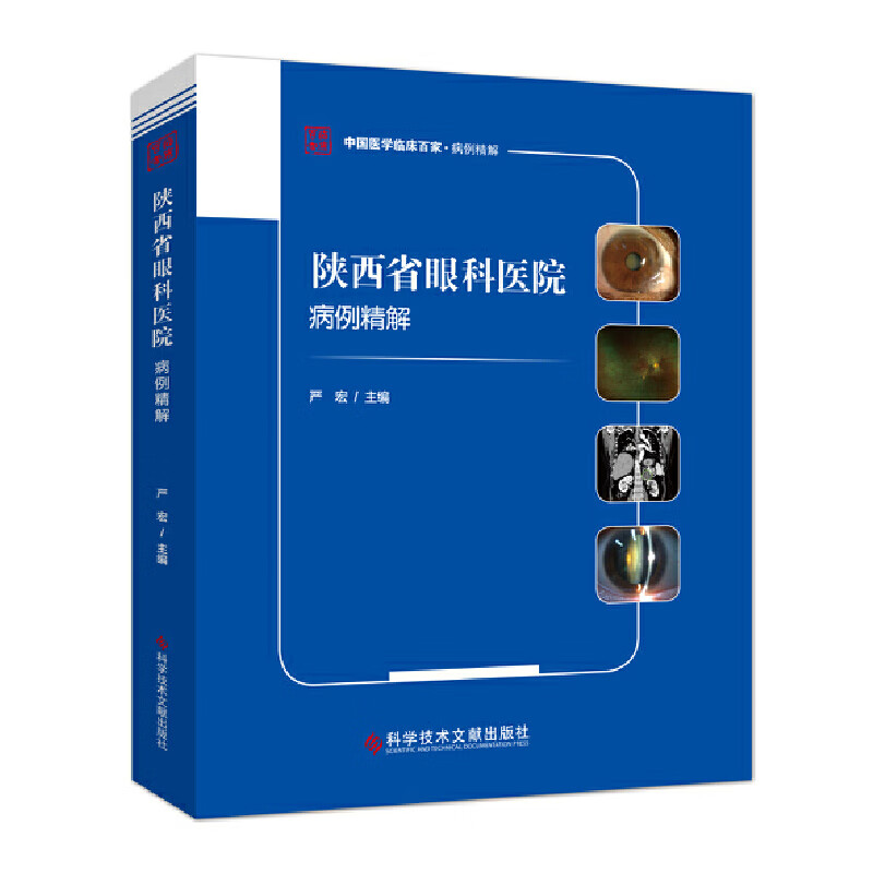 陕西省眼科医院病例精解 严宏 医学/耳鼻咽喉科学